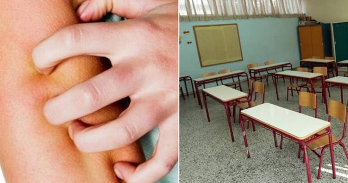 Ανησυχία: Κρούσμα νορβηγικής ψώρας σε σχολείο του Κορυδαλλού | Alfavita